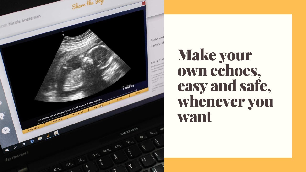Seeing My Baby At Home With Babywatcher YouTube seeing-my-baby-at-home-with-babywatcher-youtube