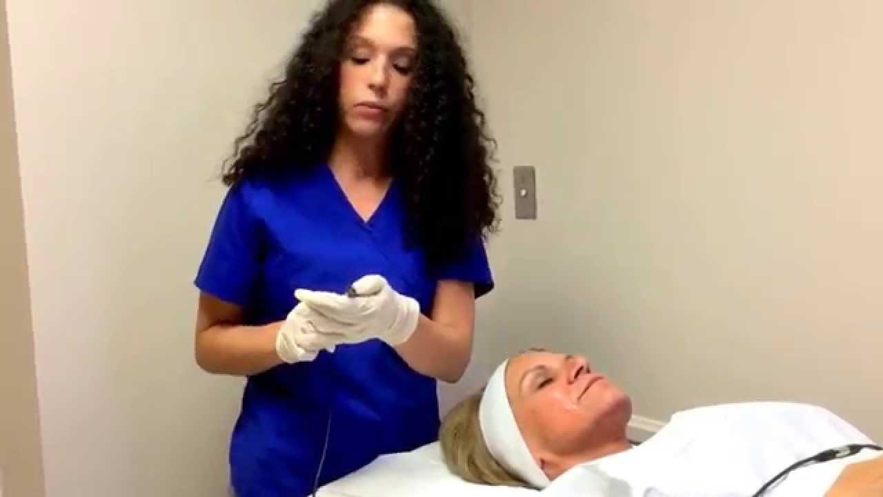 McKitty Dermatology - Microneedling Procedure Part 1 - YouTube