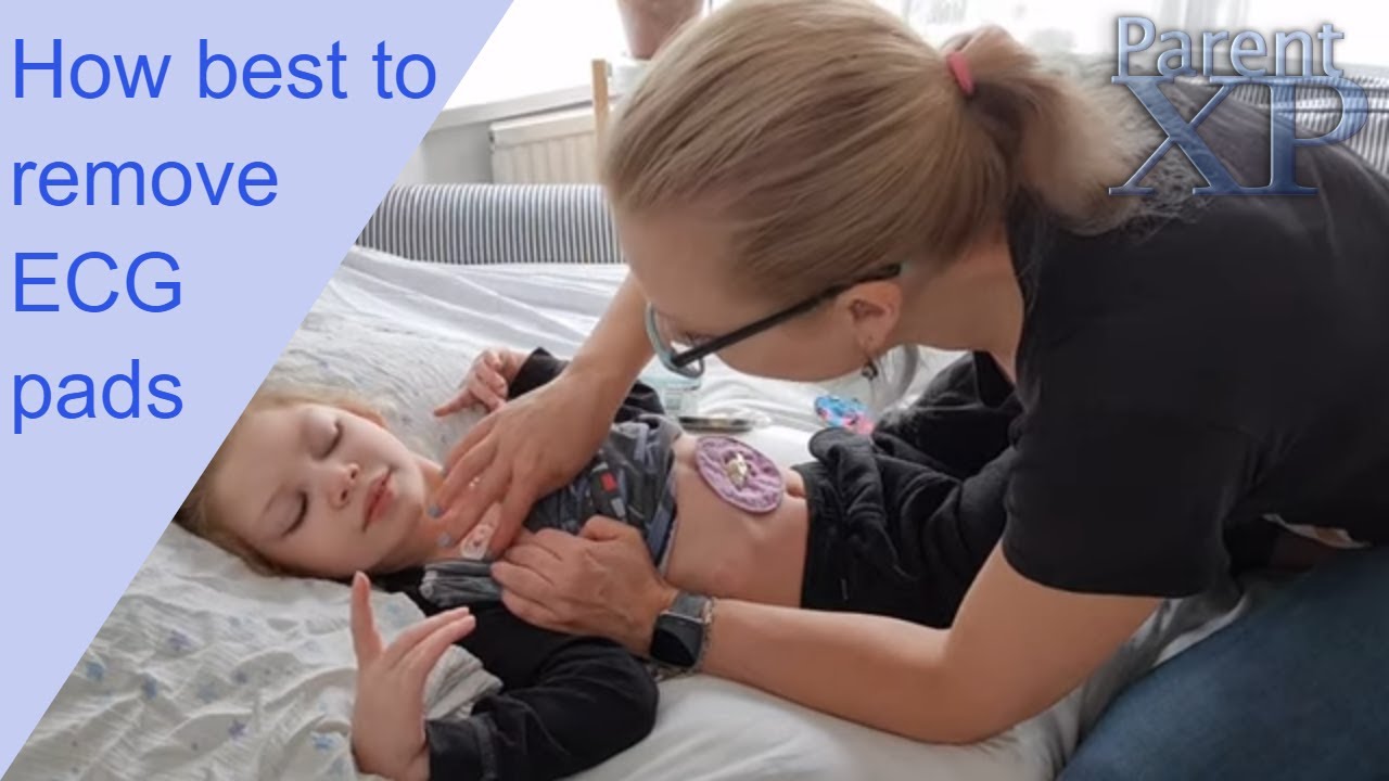 The Best Way To Remove ECG Sticky Pads YouTube the-best-way-to-remove-ecg-sticky-pads-youtube
