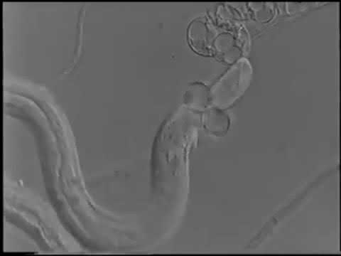 Nematode trapping fungi - Microscopic view - YouTube