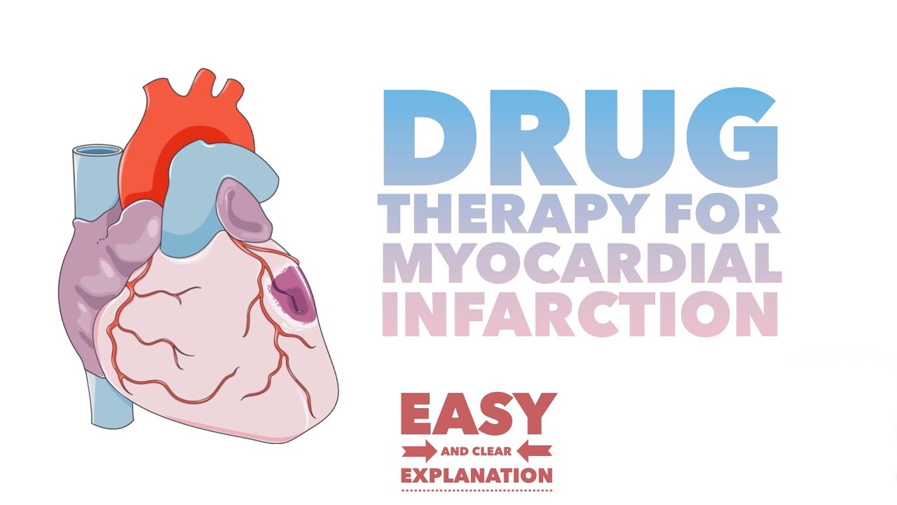Drug therapy for myocardial infarction | with easy mnemonics | clear ...
