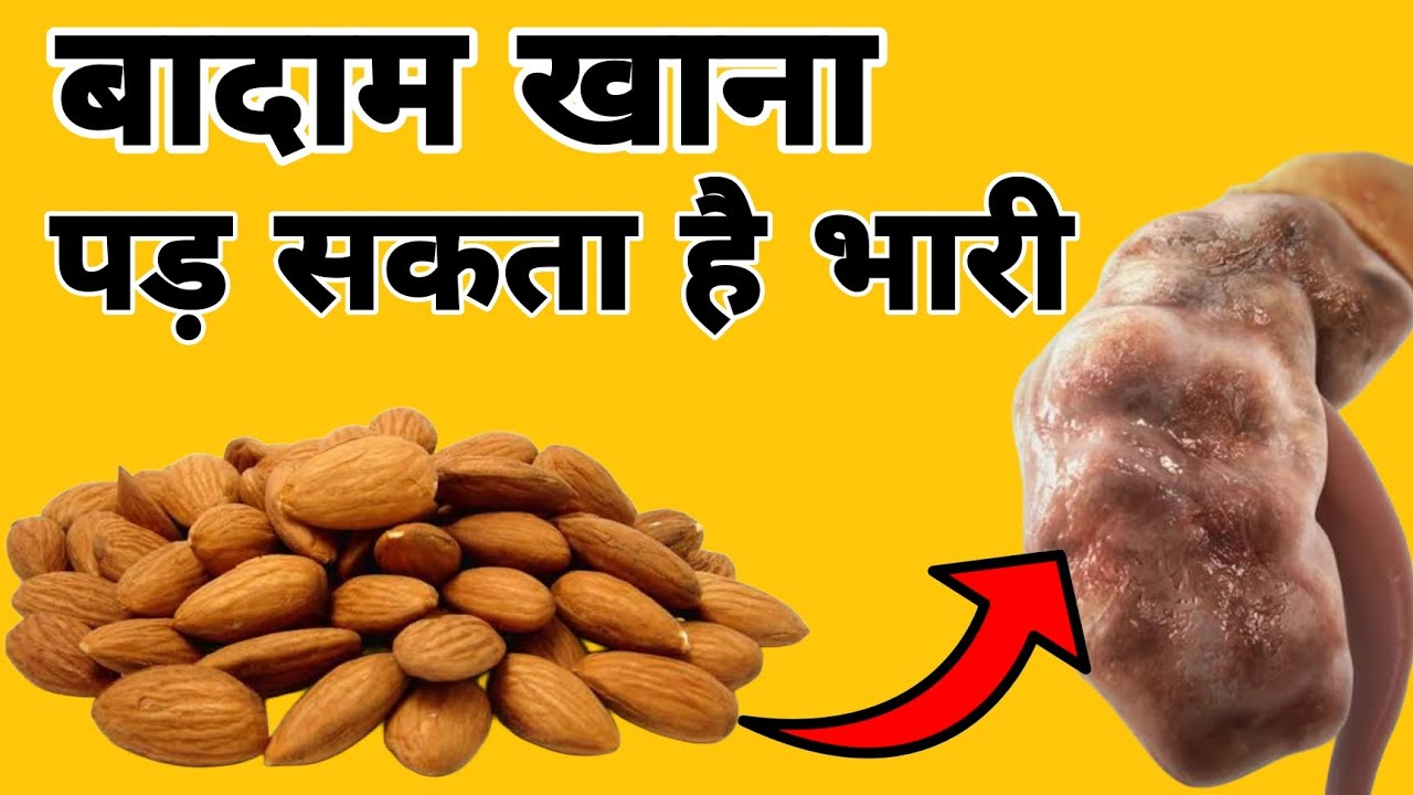 Badam Kin Logo Ko Nahi Khana Chahiye | badam khane ke fayde aur nuksan ...