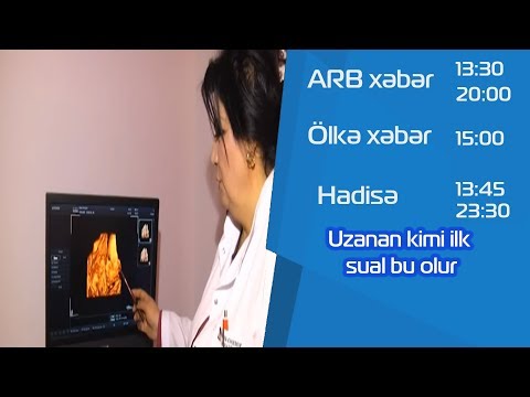 Uzanan kimi ilk sual bu olur - Oğlandır ya qız? - ARB TV