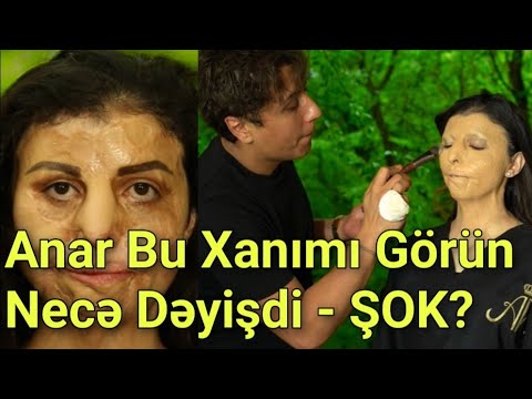 Stilist Anarın Üzü Yanan Xanımı Dəyişməsi SƏS-KÜY TÖRƏTDİ