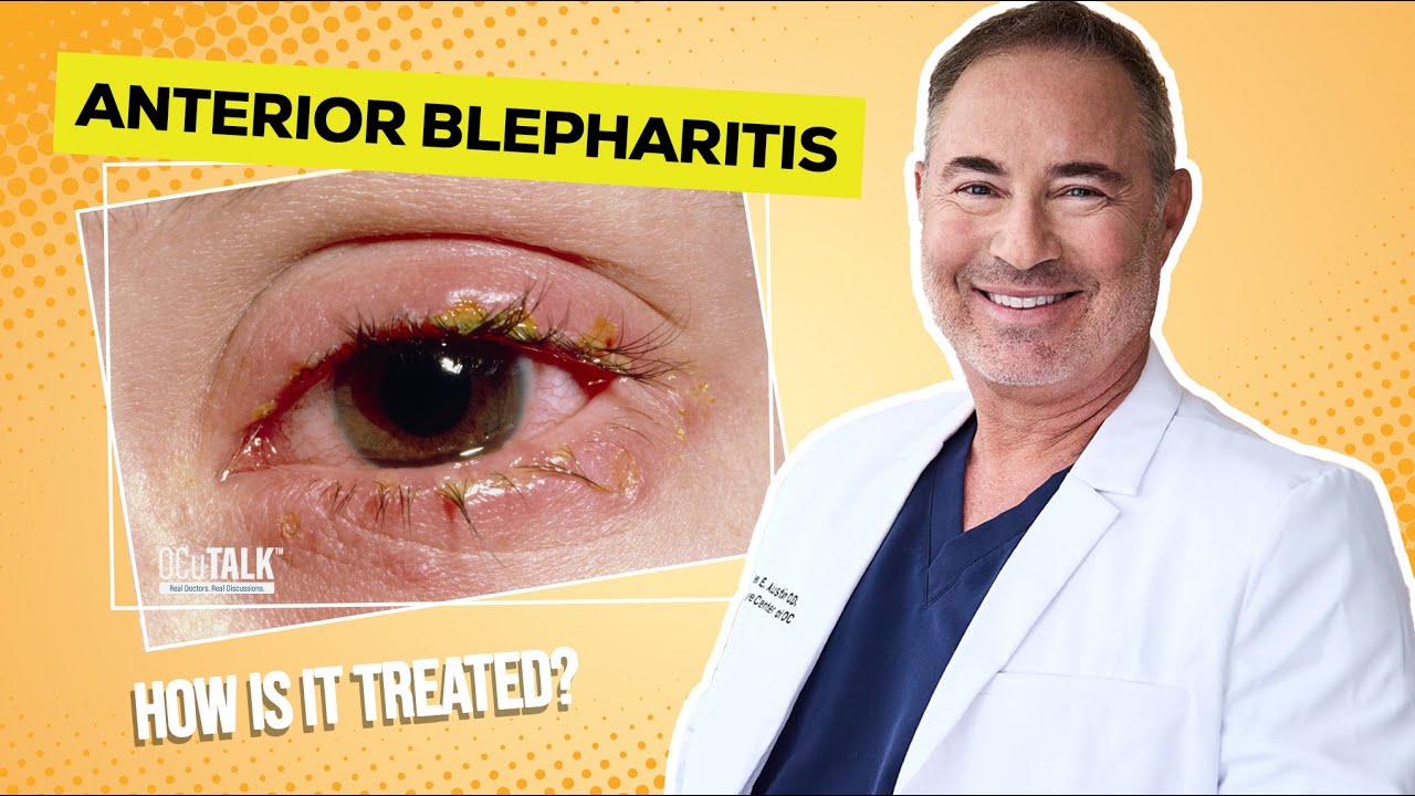 What Is Anterior Blepharitis? Causes, Symptoms & Treatments with Allen ...