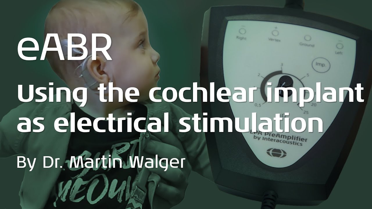 eABR in Cochlear Implantation: Using the CI as an Electrical Stimulator ...