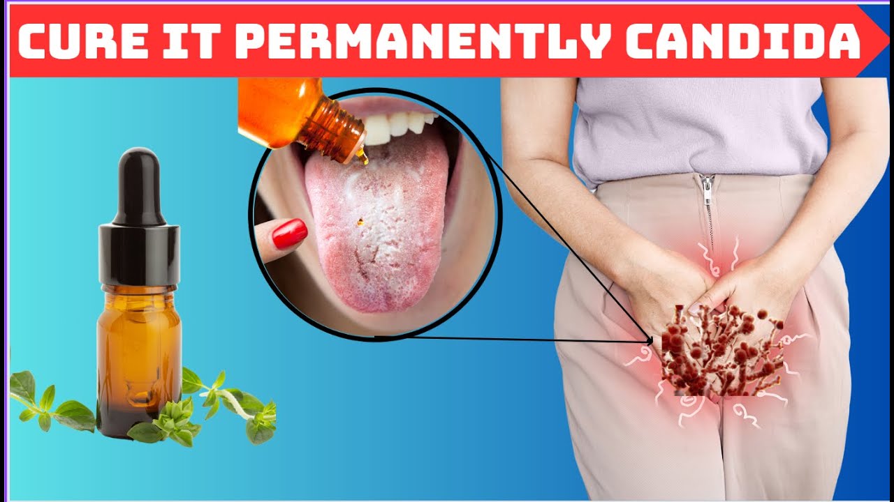 The BEST WAYS to Cure It Permanently CANDIDA - YouTube