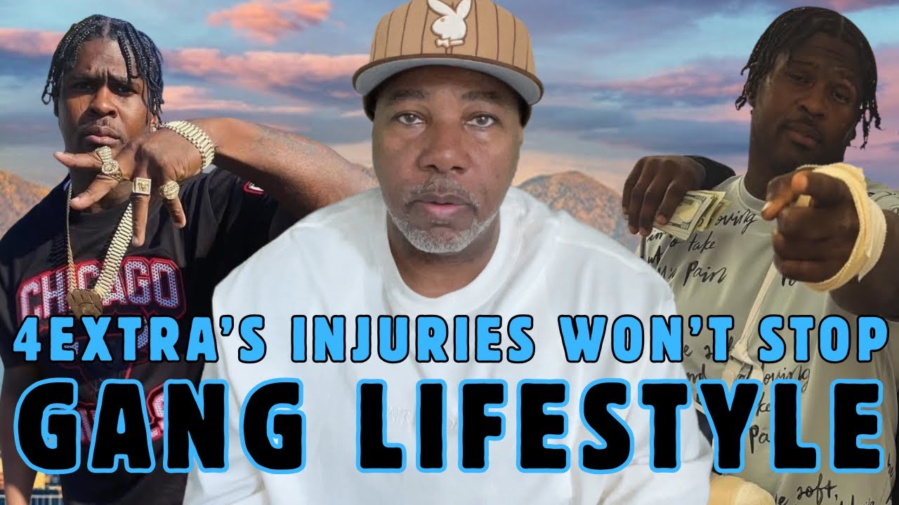 No Jumper Host 4Xtra Must Learn The Hard Way After Burning His Face ...
