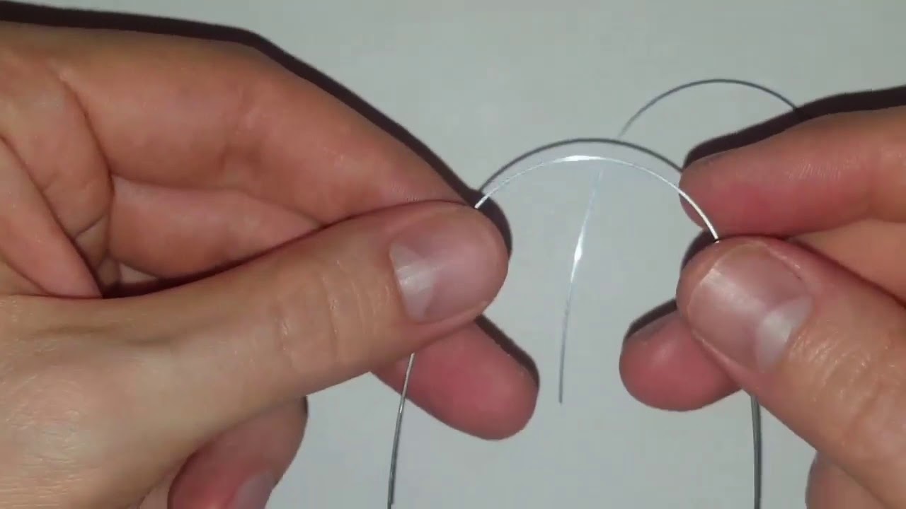 Orthodontic Archwire coordination - YouTube