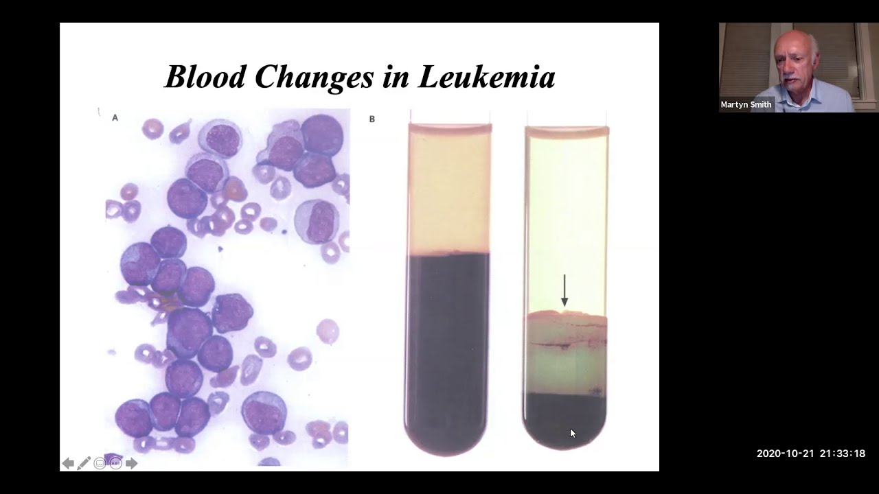 Toxicology of the Blood and Bone Marrow by Martyn Smith, Professor of ...