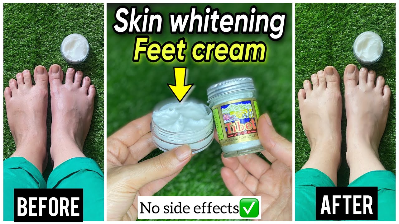 Homemade feet whitening cream | best use of tibet snow cream | foot ...