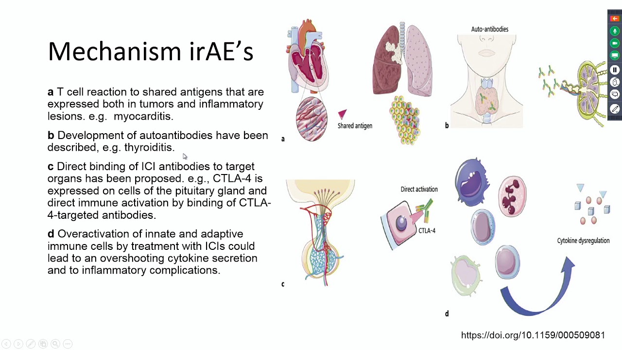 Complications of Immunotherapy in Oncology, 12/2/20 - YouTube