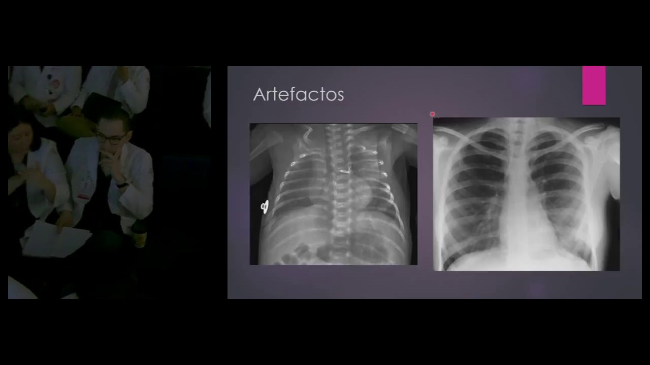 Tórax neonatal. Dra. Andrea Garza - YouTube