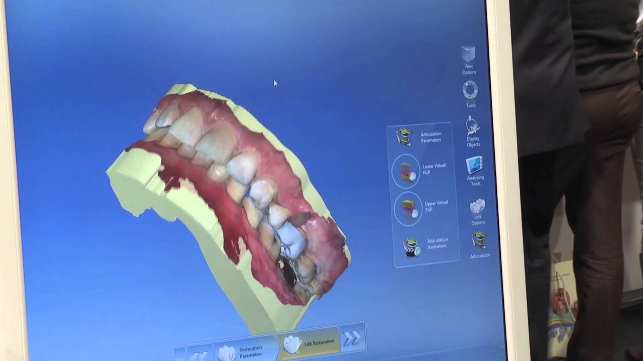 Sirona at IDS 2013: CEREC Software 4.2 - Virtual articulation - YouTube