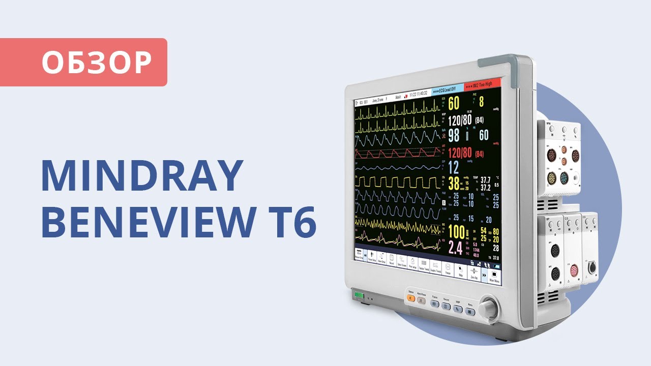Обзор от Медэк Старз | Монитор пациента Mindray BeneView T6 - YouTube