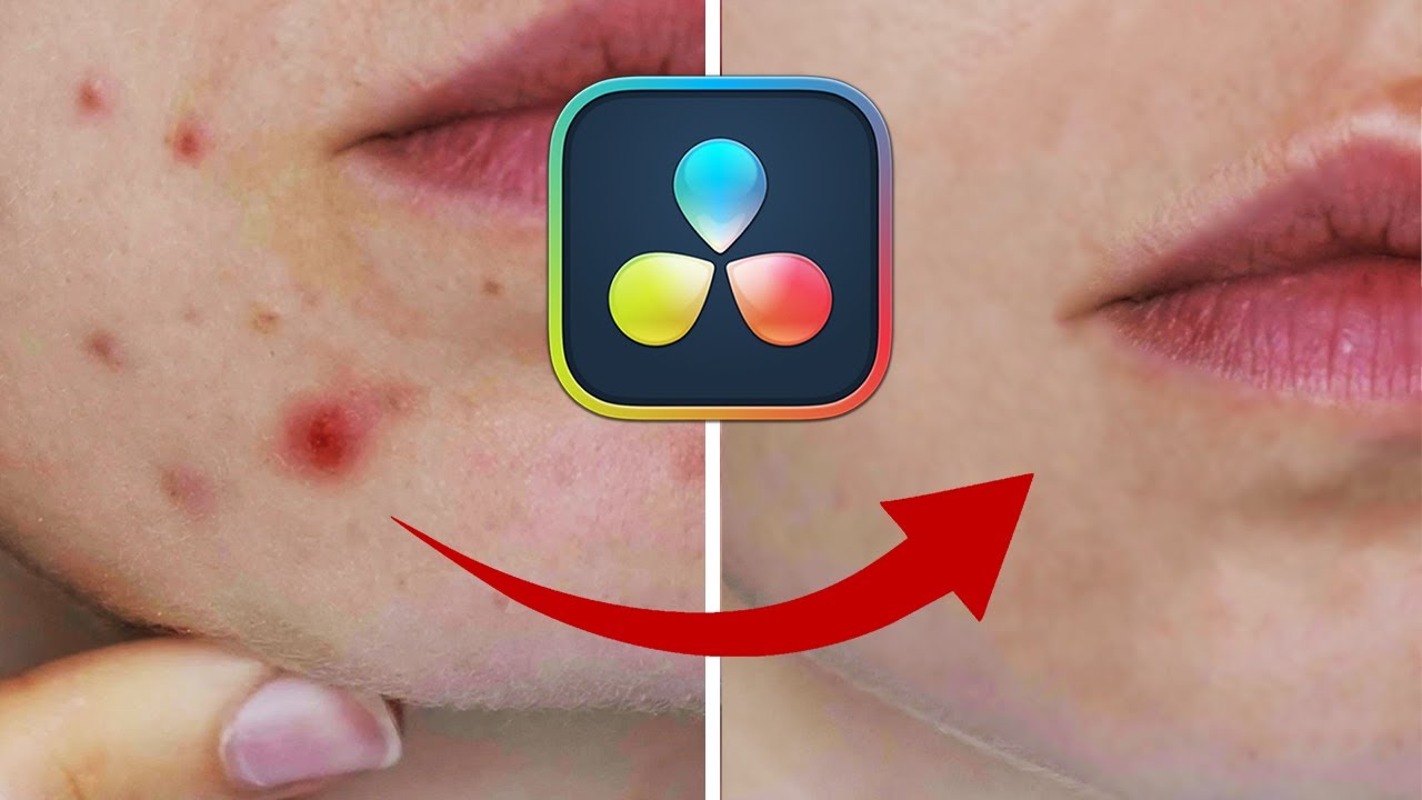 How to Remove PIMPLES, ZITS and BLEMISHES FAST in DaVinci Resolve - YouTube
