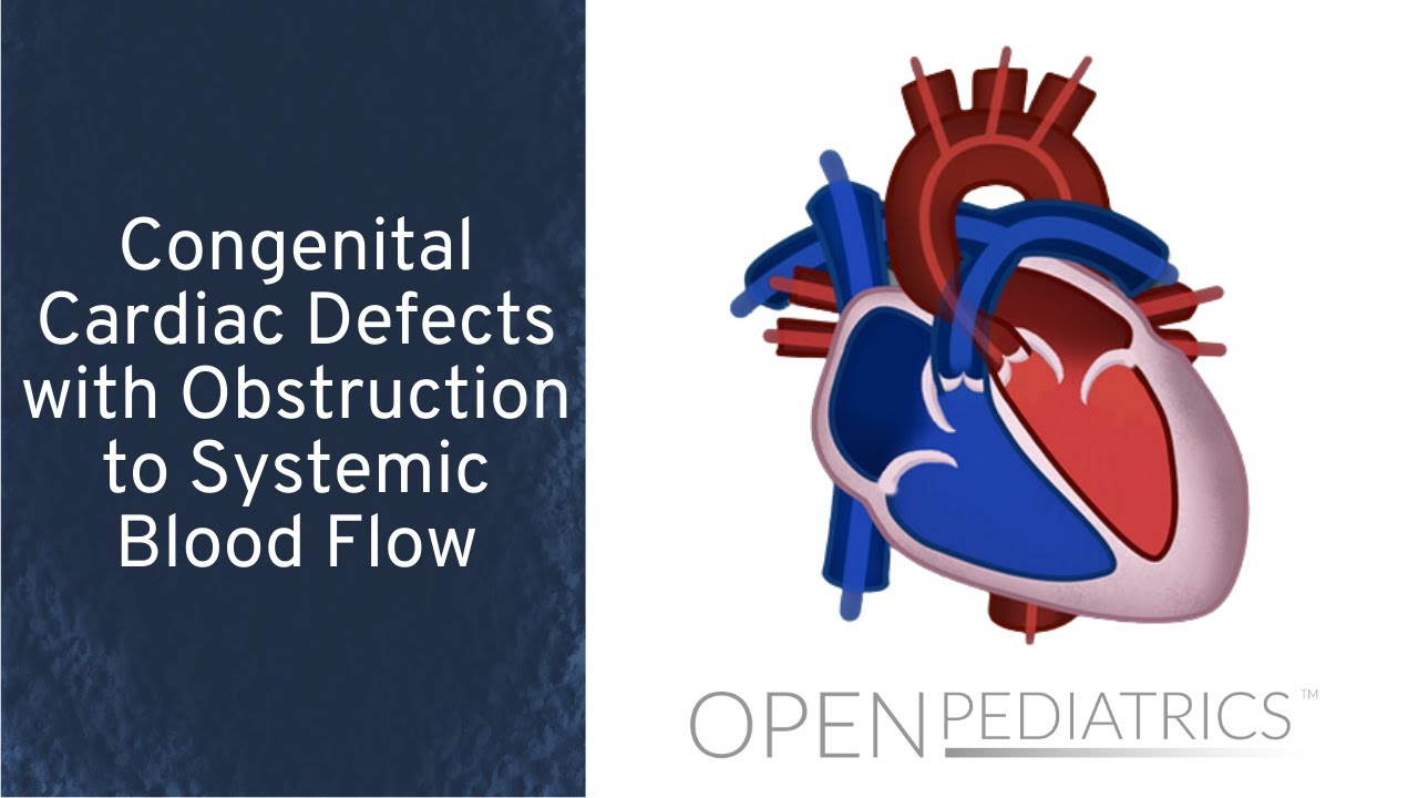 Congenital Cardiac Defects with Obstruction to Systemic Blood Flow by P ...