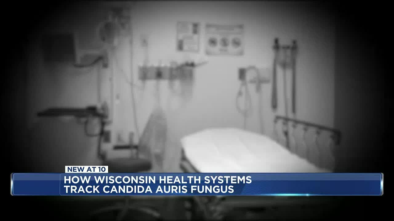 Wisconsin health systems stay on top of fungus rapidly spreading across ...