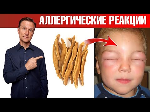 Натуральные средства при анафилактическом шоке🧐