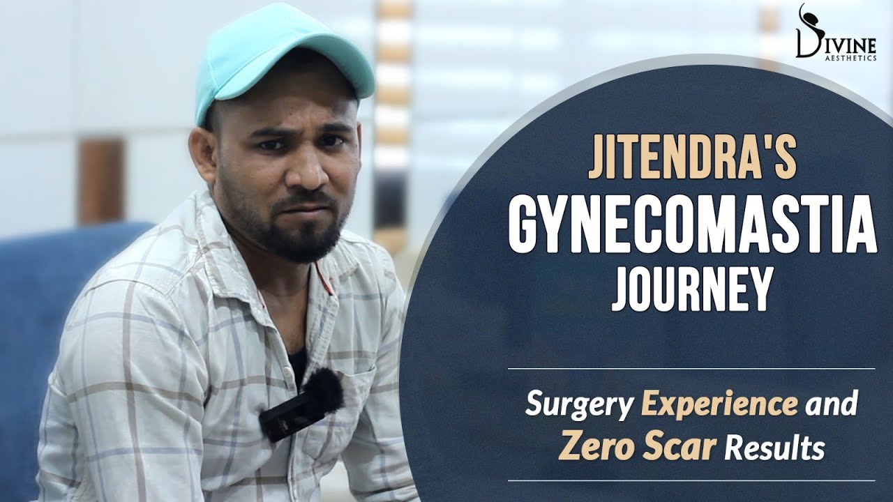 Jitendra's Gynecomastia Journey: Surgery Experience and Zero Scar ...