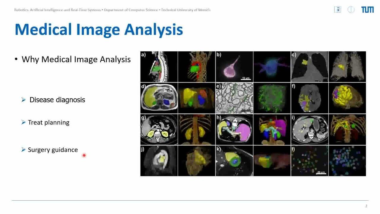 Swin-Unet: Unet-like Pure Transformer for Medical Image Segmentation ... Swin-Unet: Unet-like Pure Transformer for Medical Image Segmentation ...