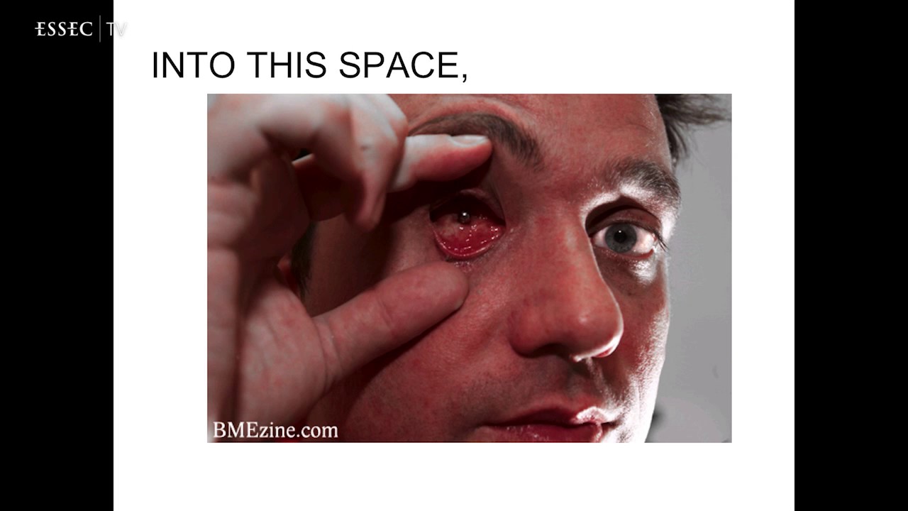 The Eyeborg Project, Rob Spence, iMagination Week 2017 - YouTube