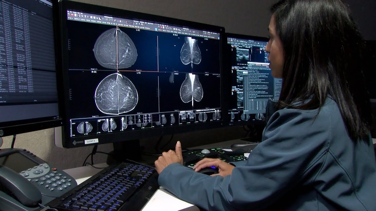 Mayo Clinic Minute What Is Mbi And Who Needs It Youtube