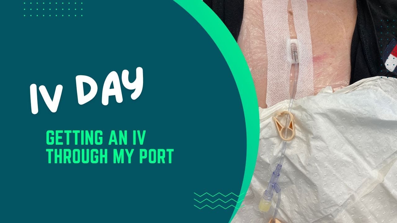 IV Day - getting an IV through my port - YouTube