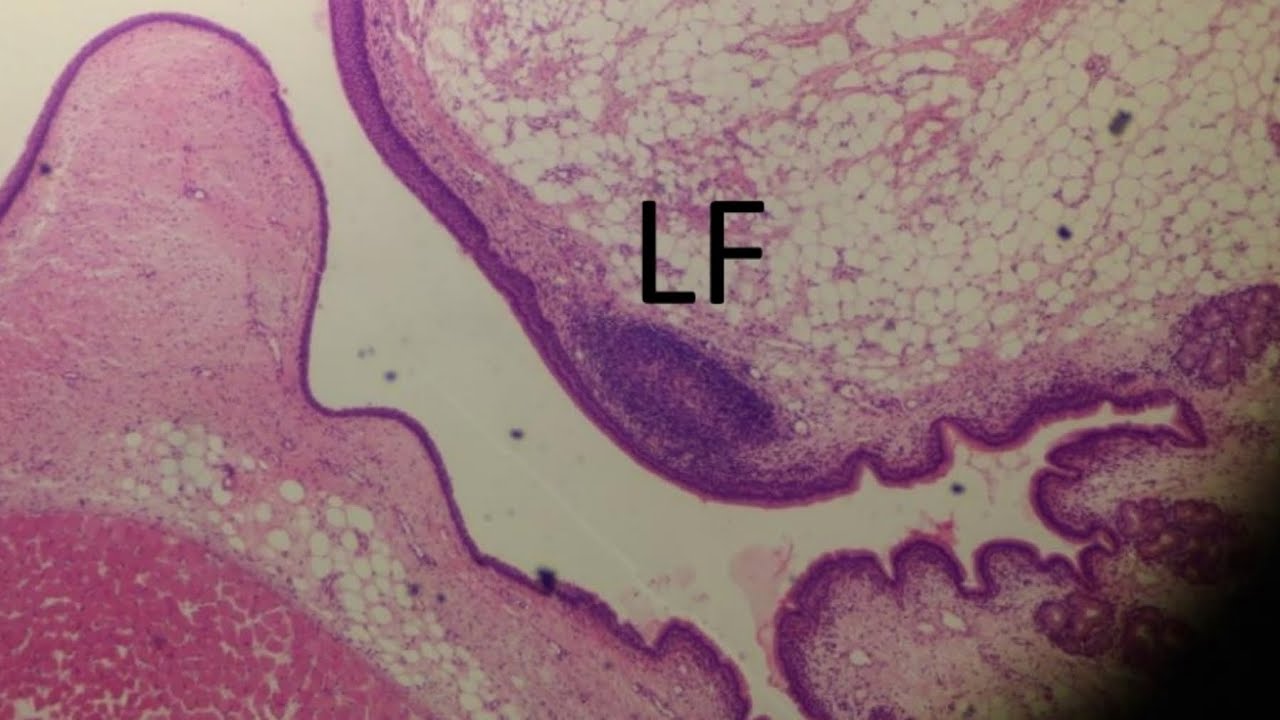 larynx | histo slide - YouTube