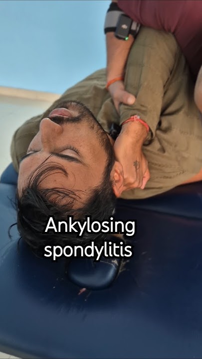 Chiropractic Treatment for ankylosing spondylitis! Upper back adjustment #youngspineclinic - YouTube
