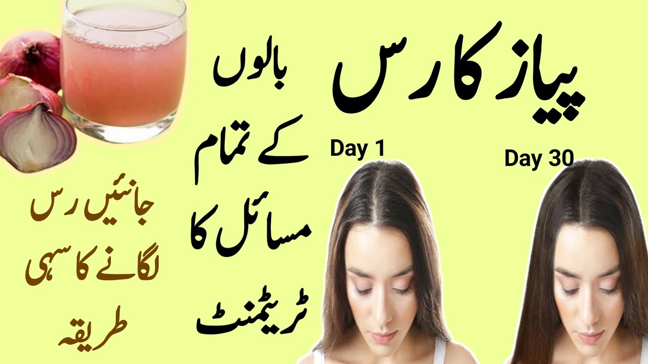 Pyaz Ka Ras For Hair | Pyaz Ka Ras kaise Nikale | Onion Juice For Hair ...