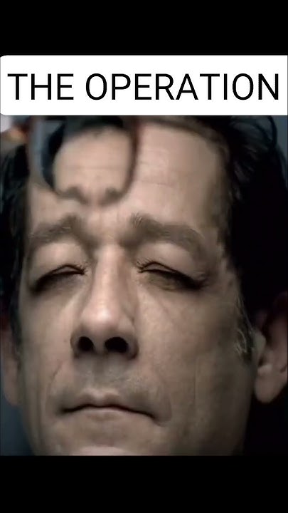 THE OPERATION". - YouTube