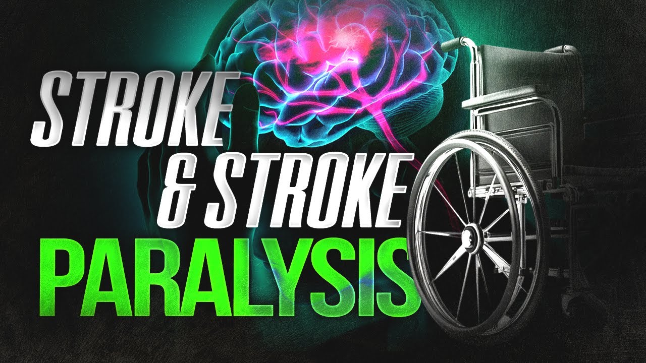 Fruit Fasting Can Prevent STROKE And Reverse POST STROKE PARALYSIS ...