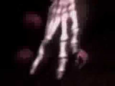 The Dancing Corpse Hand - YouTube