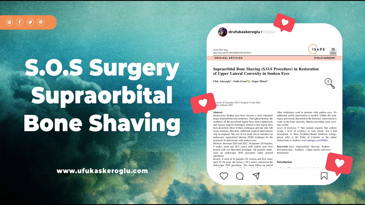 S.O.S Surgery Supraorbital Bone Shaving - YouTube
