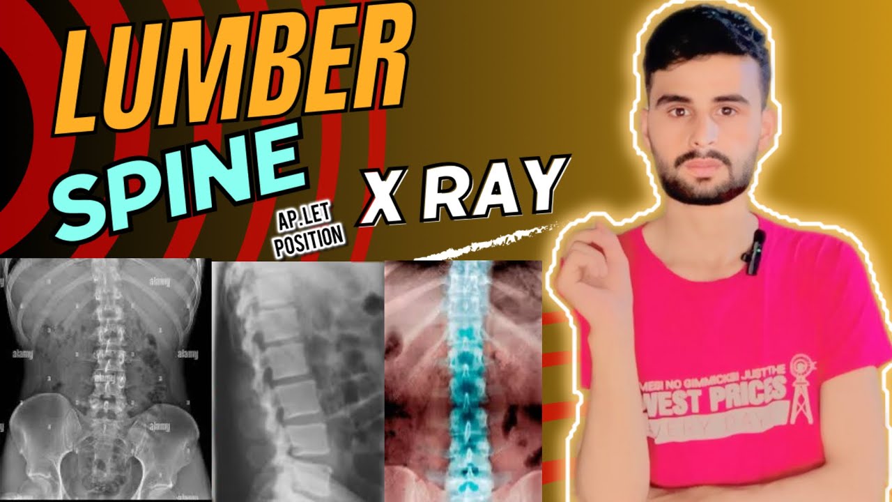 Lumber spine | lumber spine x ray , lumber spine c ray positioning | x ...