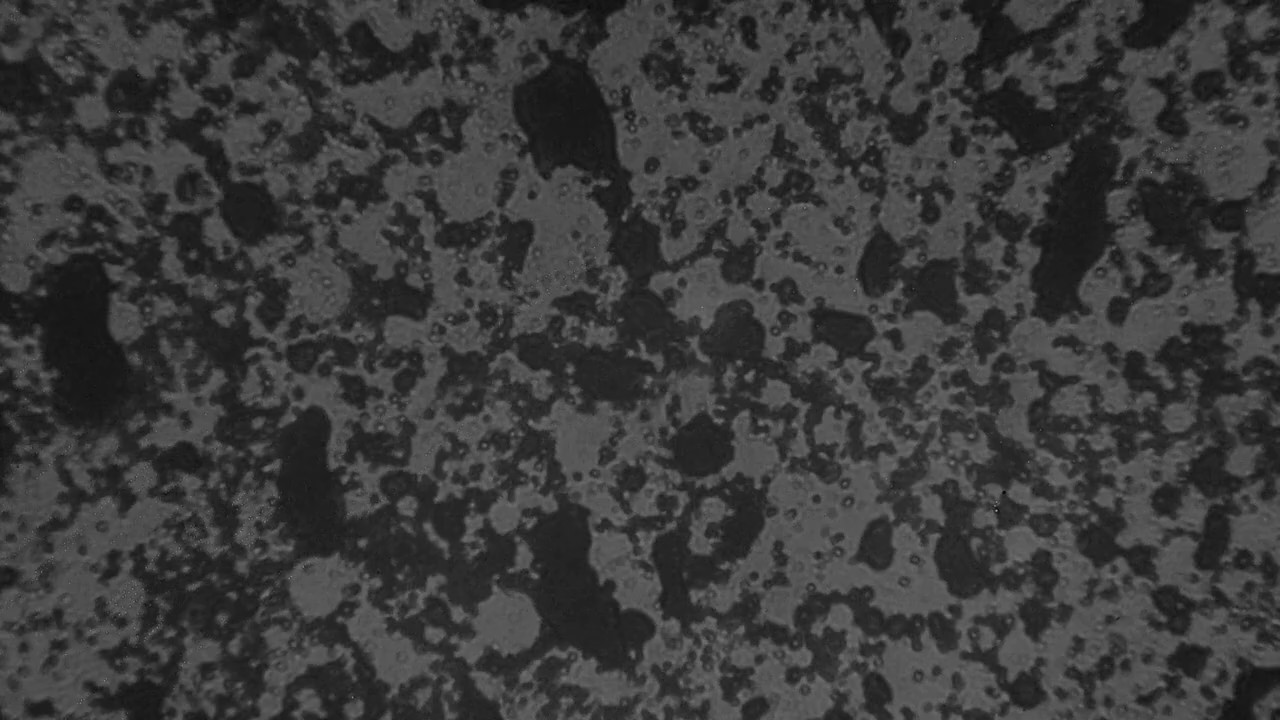 UV microscope video clip of sunscreen - YouTube