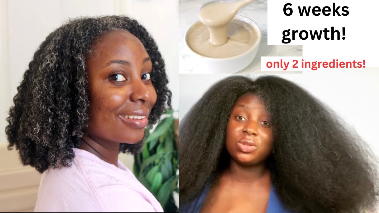 I Have Literally Doubled My Hair Growth With This One Treatment! - YouTube