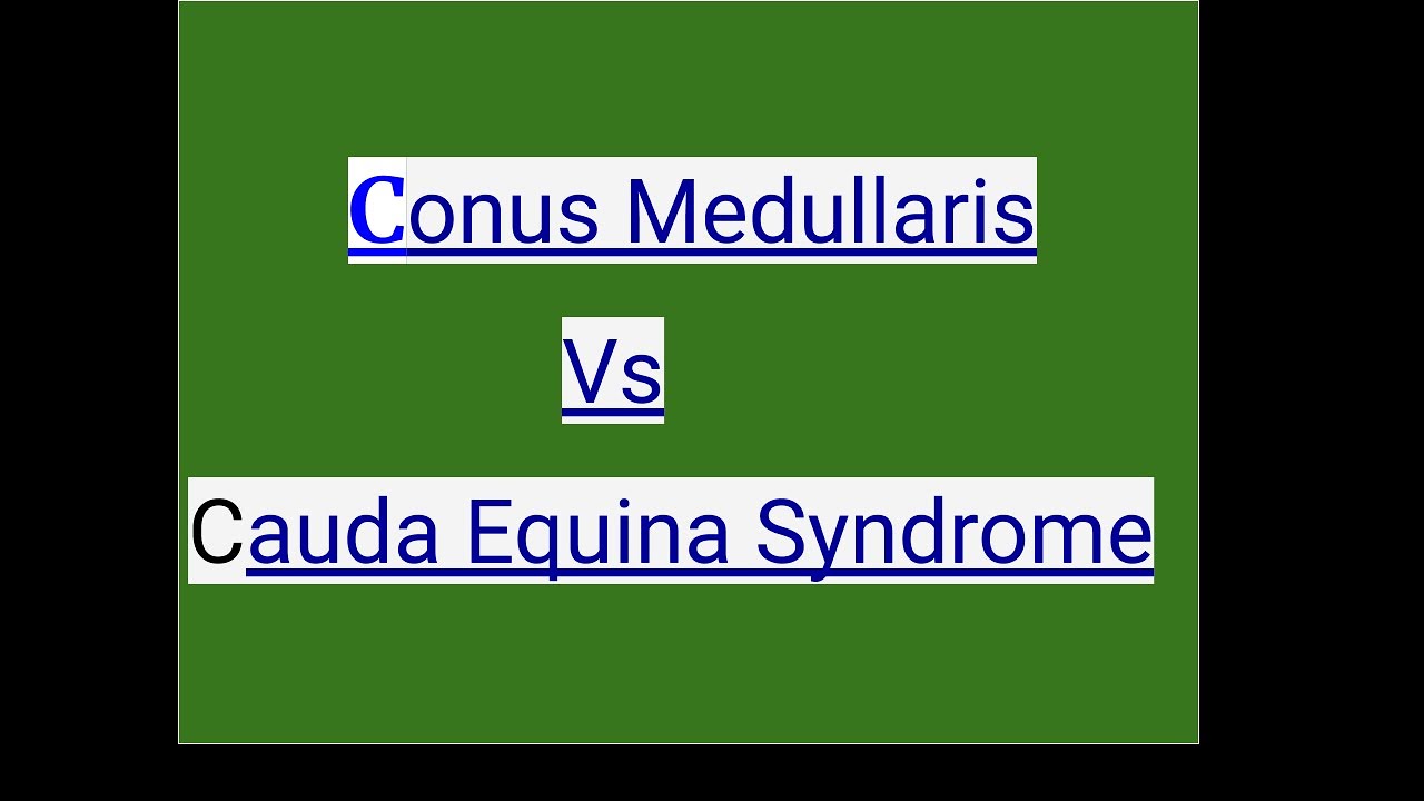 Conus Medullaris Vs cauda Equina Syndrome - YouTube