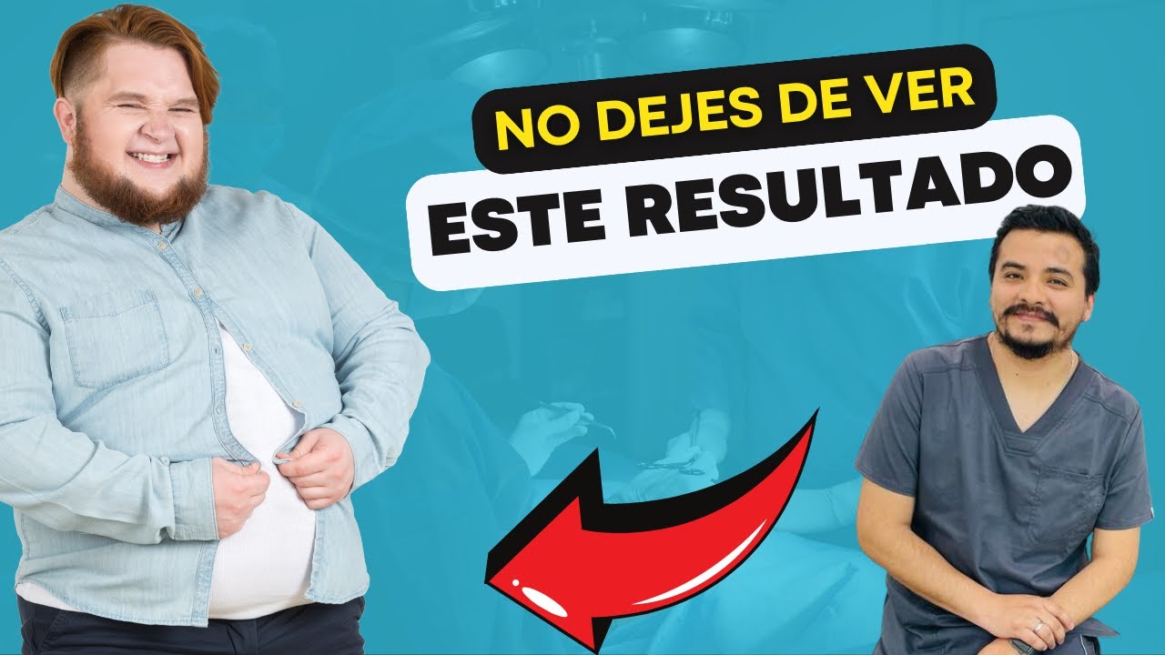 Impactante resultado de cirugía de alargamento de pene en paciente obeso en Perú - YouTube