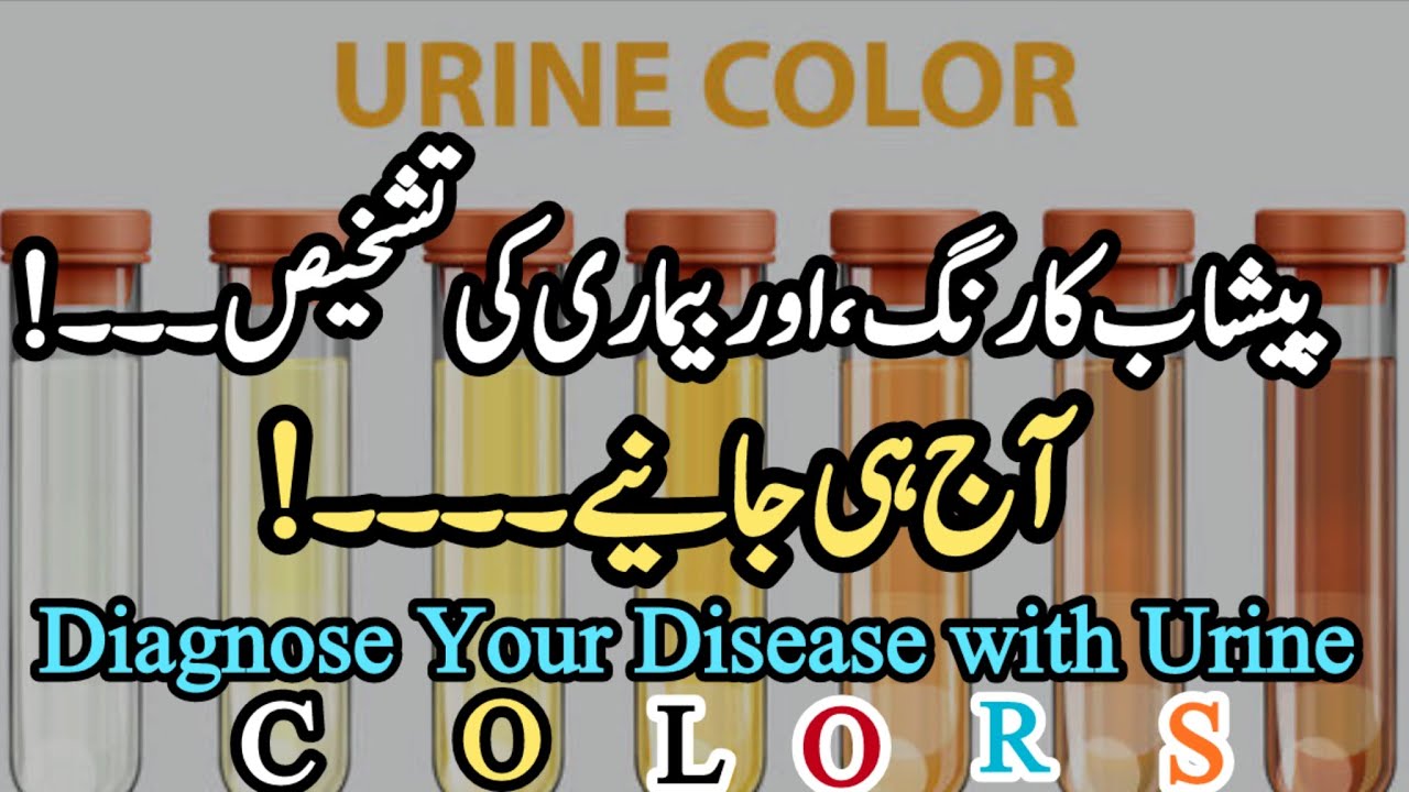 Color Of Urine Tells you the disease || Here are the Facts - YouTube