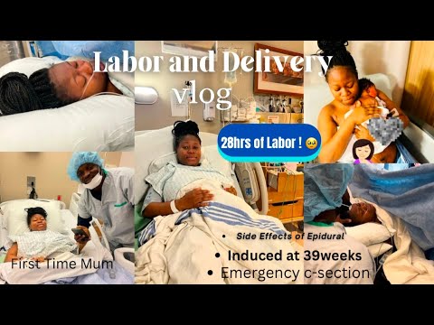 Giving Birth in Canada | Side effect of Epidural | Emergency C-Section ...