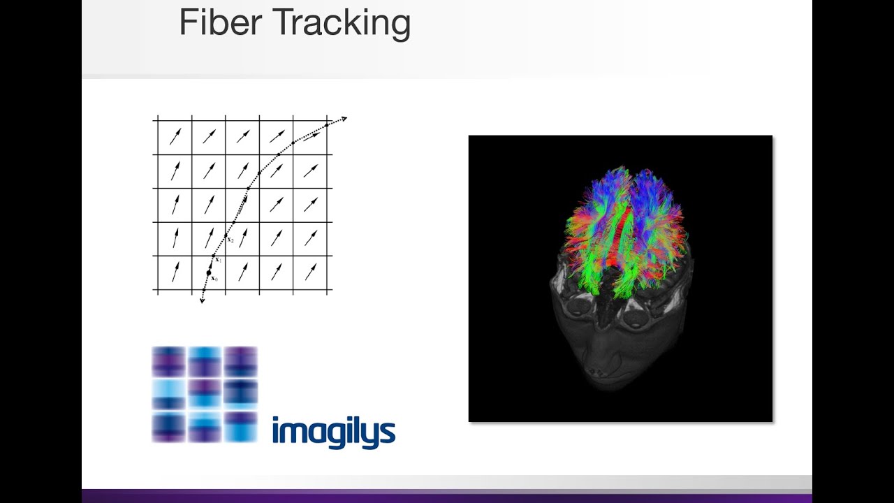 Webinar: Fiber Tracking - YouTube