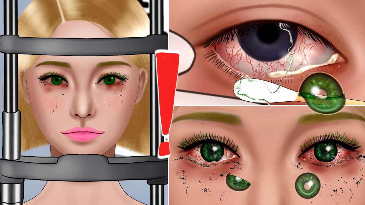 ASMR Removal of Eye Mucus String & Many Contact Lenses Animation‼️ ...