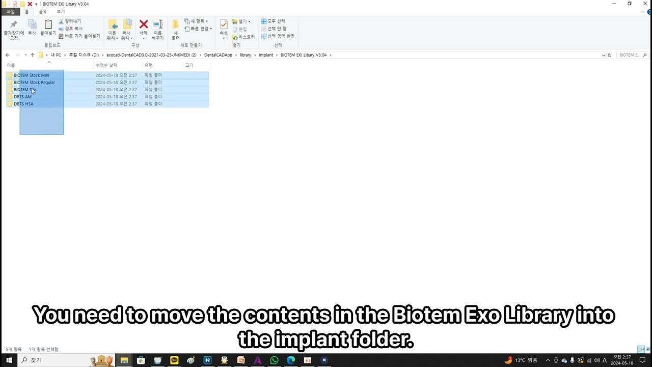 exocad libary install video - YouTube