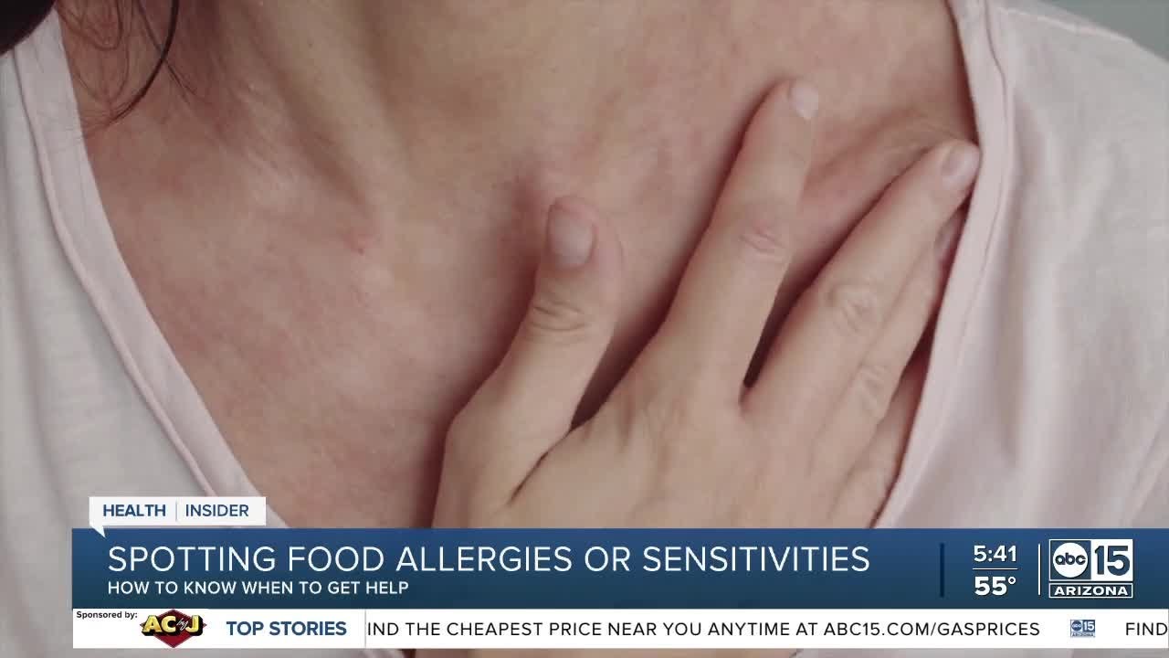 Spotting food sensitivities or allergies - YouTube