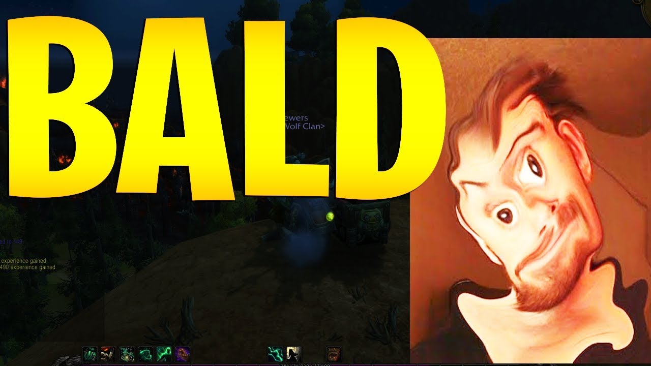 Asmongold Complains About Going Bald - YouTube