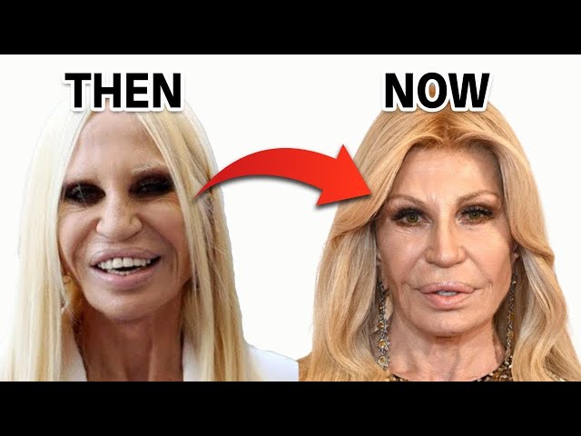 Donatella Versace Young Donatella Versace's Face Transformation Over