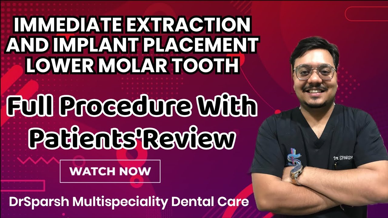 Immediate Extraction and Implant Placement Lower Molar Tooth Full Video ...