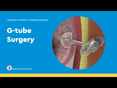 G-tube Surgery